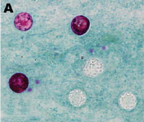 Cyclospora spp :: A