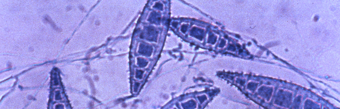 Microsporidium spp :: A