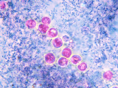 Cyclospora spp :: A