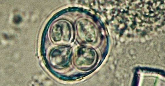 Cyclospora spp :: A